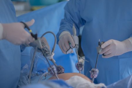 Tudo o que você precisa saber sobre a laparoscopia | Instituto Crispi